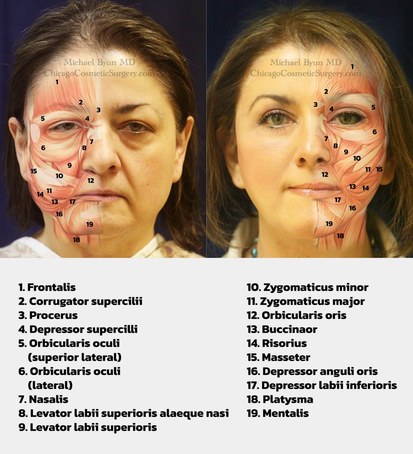 Cosmetic Surgery & Plastic Surgeon Chicago - Dr Michael BYUN