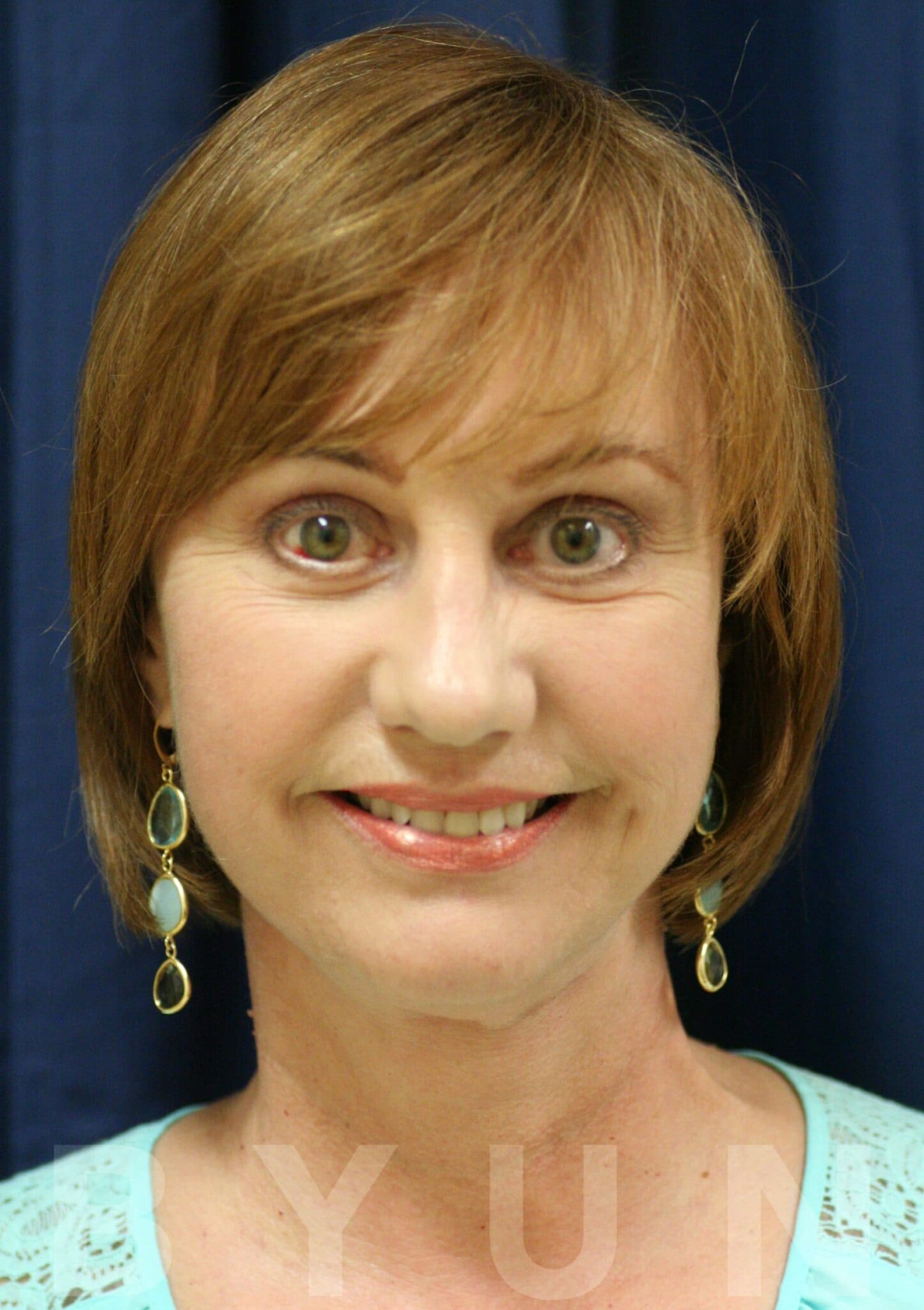 BYUN Techniques - Dr. Michael BYUN