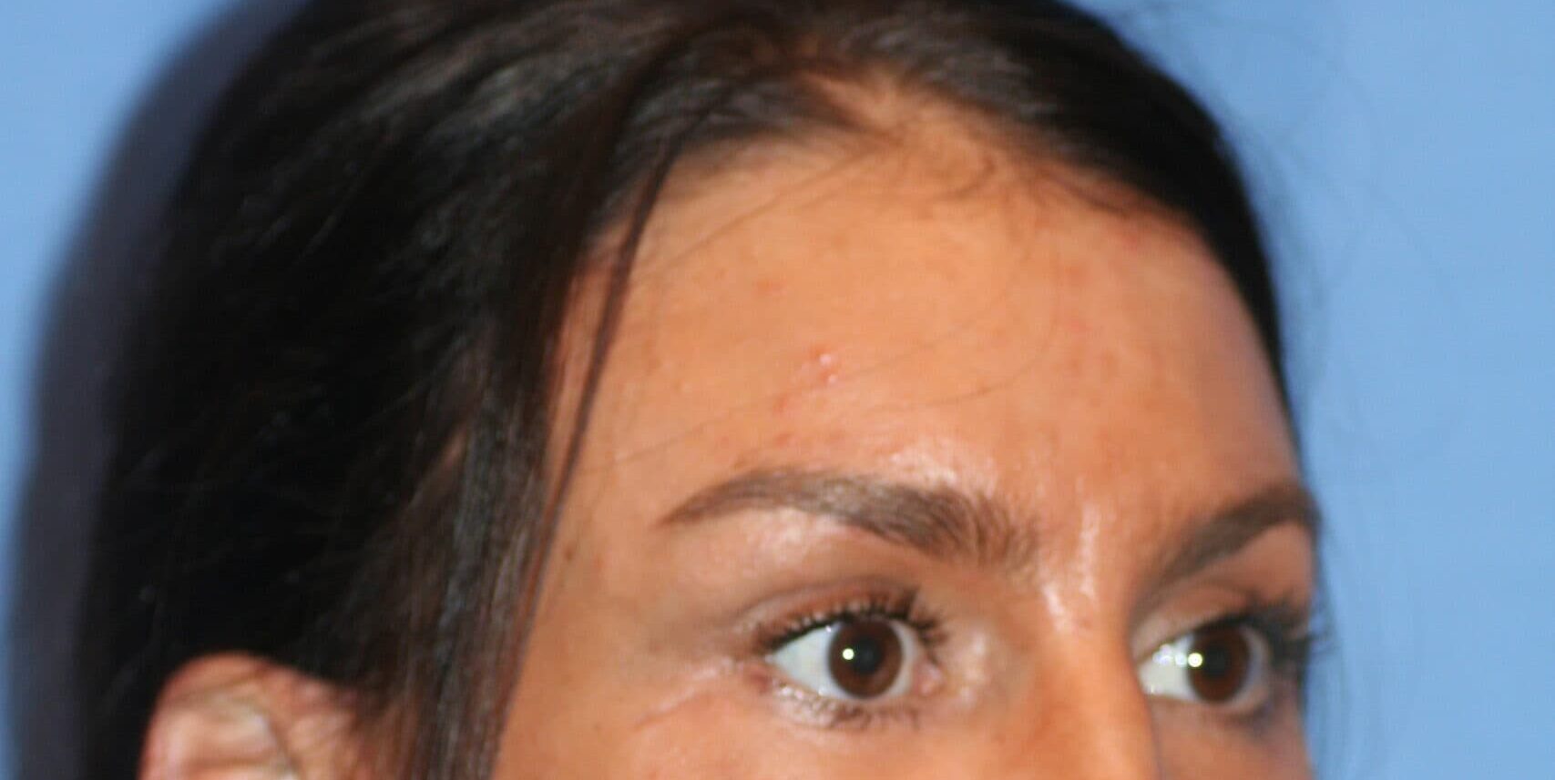 BYUN Techniques - Dr. Michael BYUN