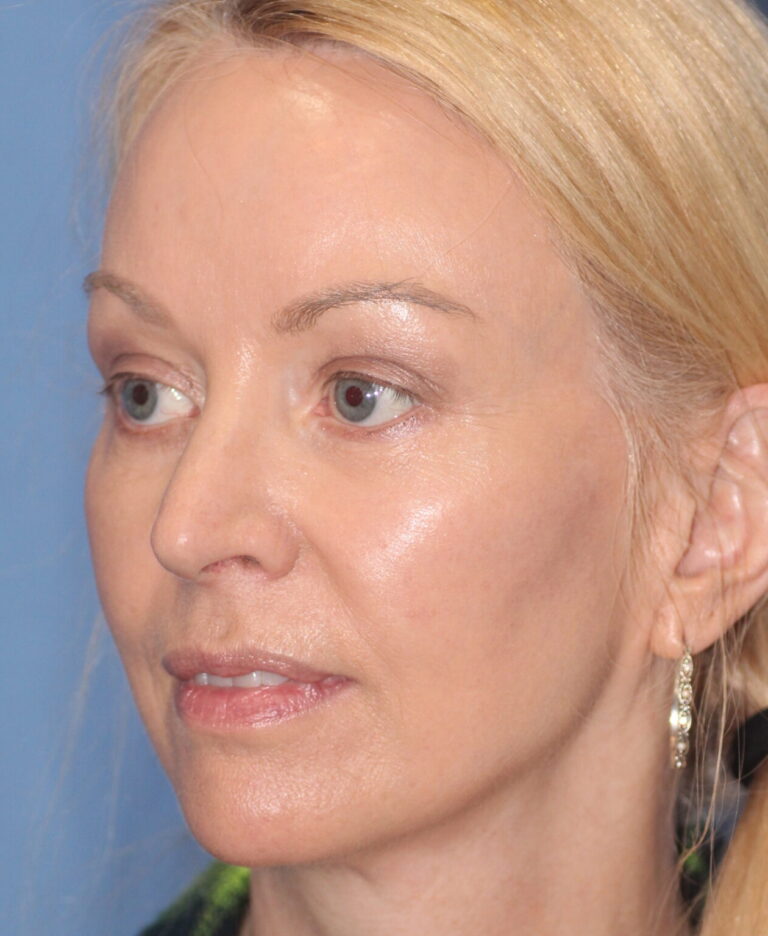 Cosmetic Surgery & Plastic Surgeon Chicago - Dr Michael BYUN