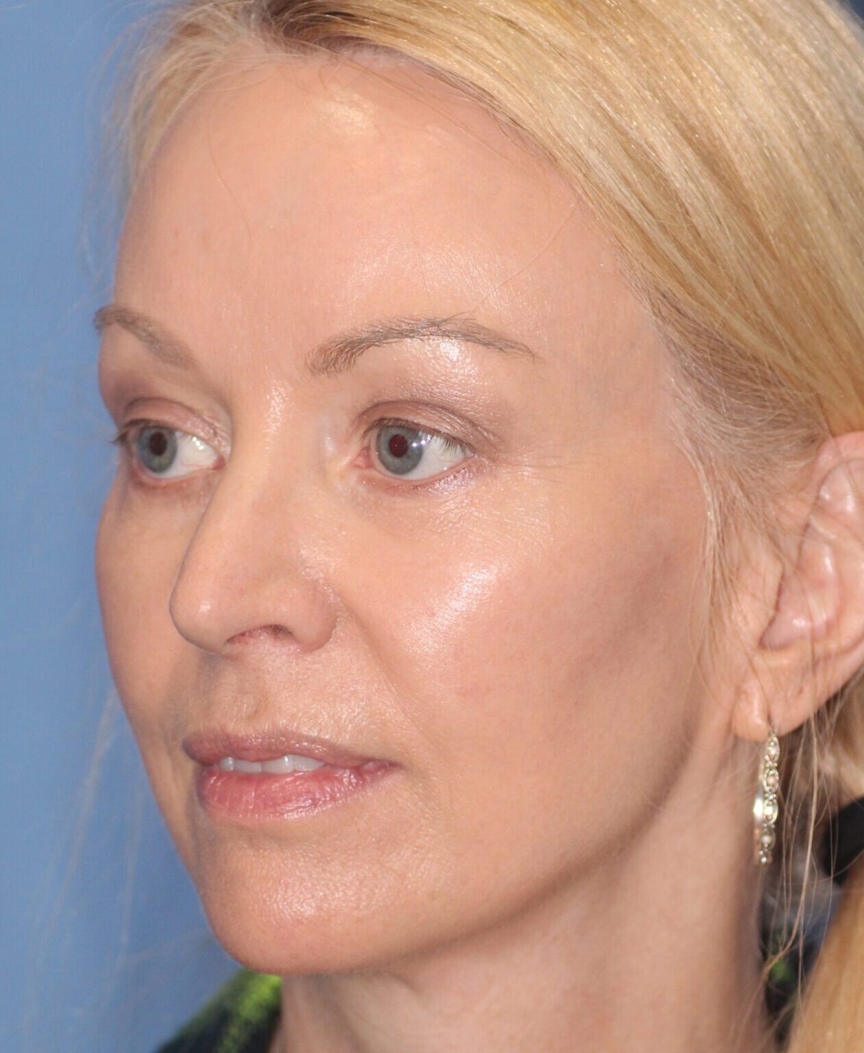 Cosmetic Surgery & Plastic Surgeon Chicago - Dr Michael BYUN