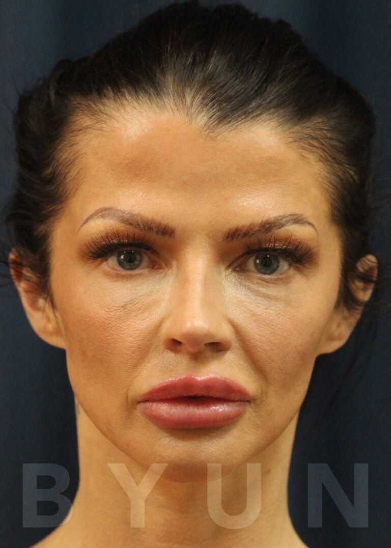 Cosmetic Surgery & Plastic Surgeon Chicago - Dr Michael BYUN